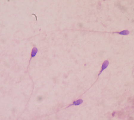 Sperm Cell - Key Stage Wiki