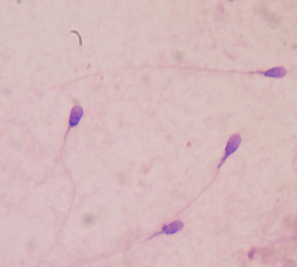 Sperm Cell - Key Stage Wiki